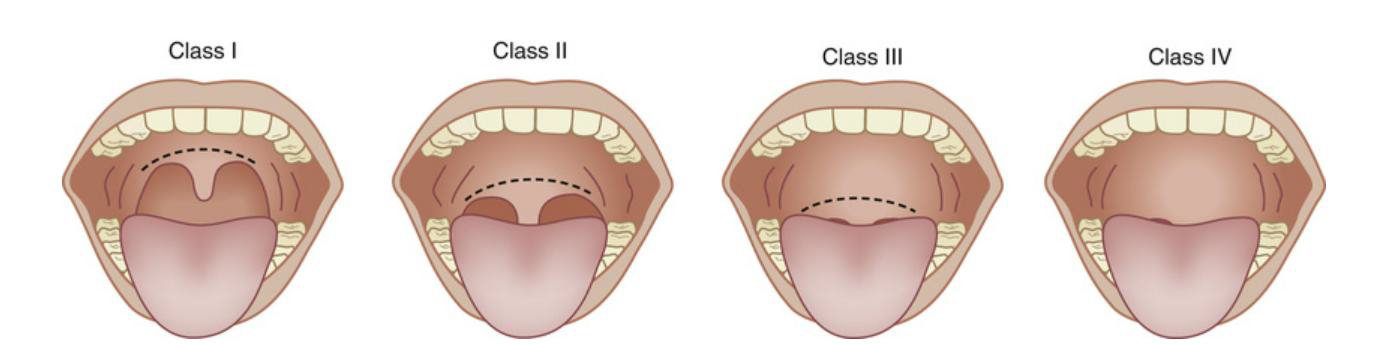 Khám bệnh toàn diện người có rối loạn giấc ngủ – Chi Hội Y Học Giấc Ngủ ...